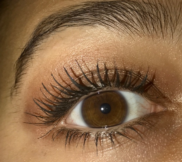 What are these lines in my eyes? - Glow Community