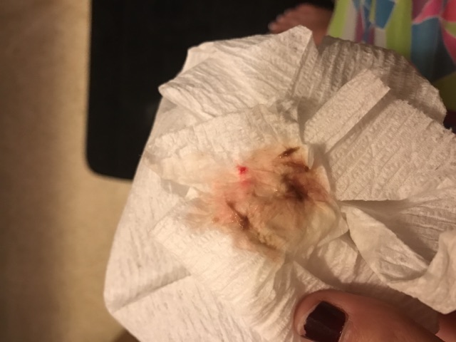 Implantation bleeding? 8dpo - Glow Community