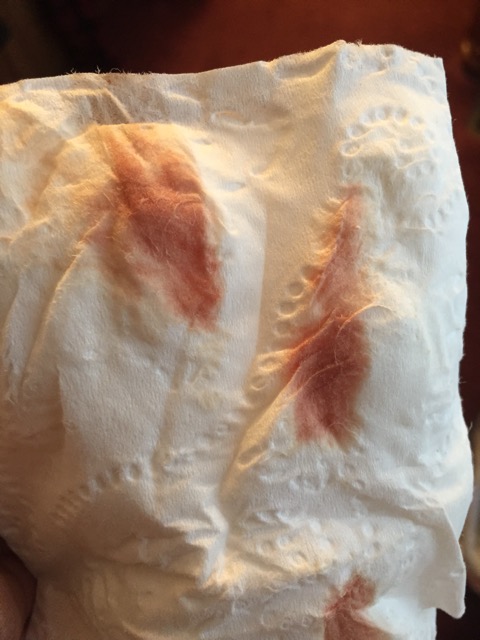 Tmi picture!!! Blood on toilet paper - Glow Community