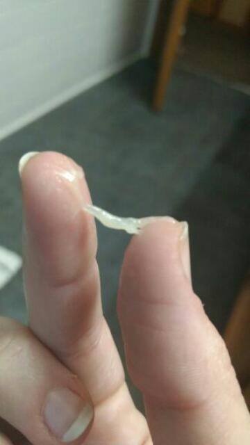 ***TMI*** mucus plug?! - Glow Community