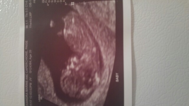 Lets see your 11 week ultrasounds 💓 - Glow Community