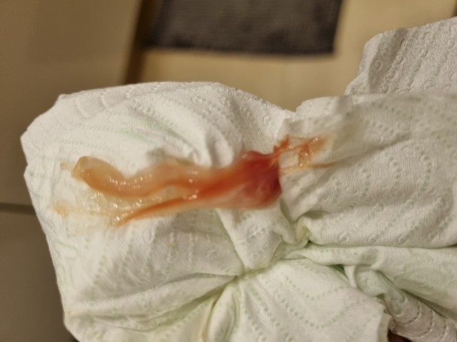 Cervix Exam 31 weeks + Mucus Plug...Should I be worried?!?!? - Glow ...