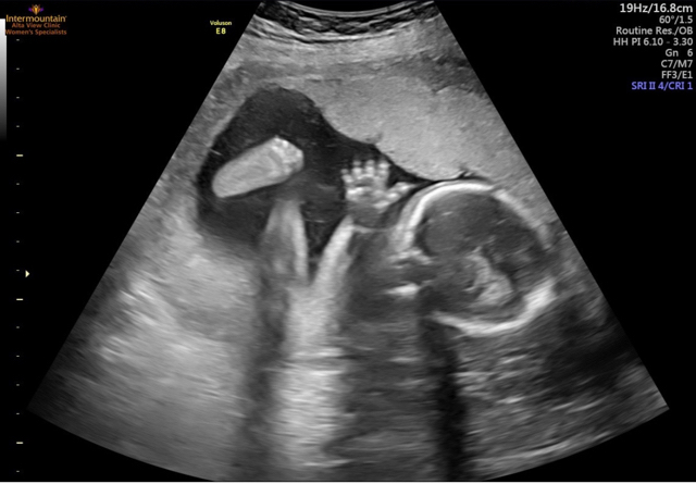 19w4d ultrasound of my sweet baby boy - Glow Community