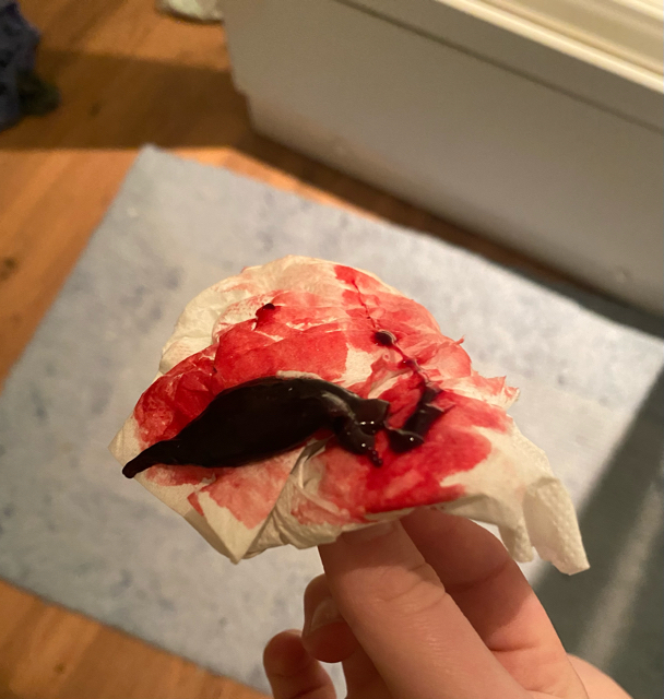 Period accident in public. And HUGE blood clot - Glow Community