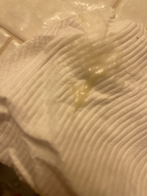 WARNING TMI : mucus plug or discharge? - Glow Community