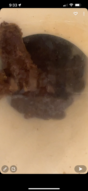 Is this normal color poop? TMI!!! Actual photos! - Glow Community