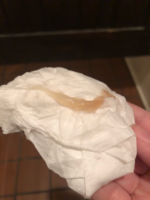 Cervical Mucus (TMI?) - Glow Community