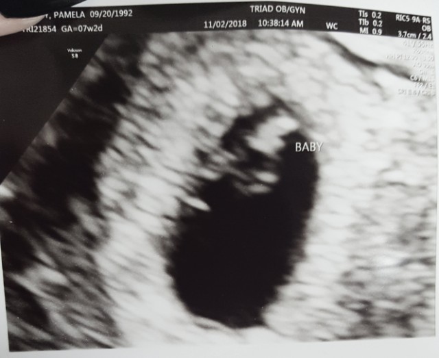 First ultrasound and heartbeat was heard! Is 102 BPM normal for 5 wks ...