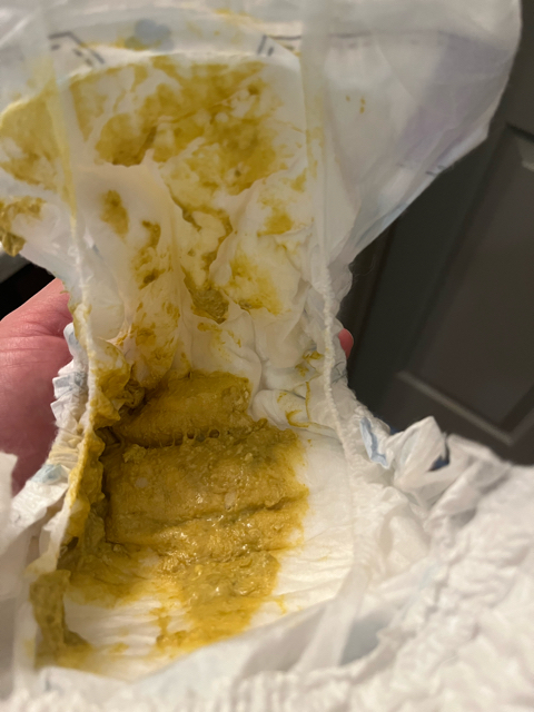 Formula Fed Baby Poop