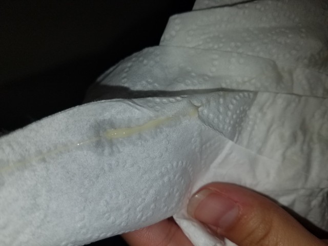 Yellow Green Discharge Odor