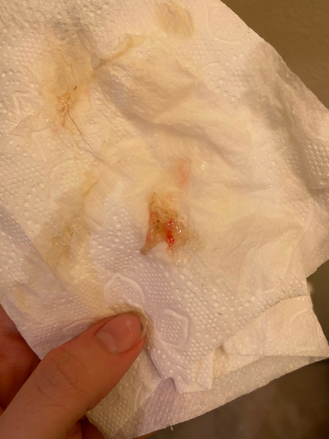 TMI - bum leaking discharge with traces of blood - Glow Community