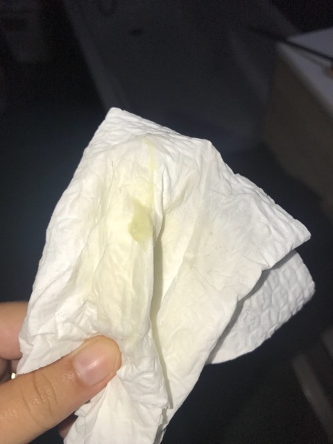 TMI!!!! Tissue with discharge/mucus plug? - Glow Community