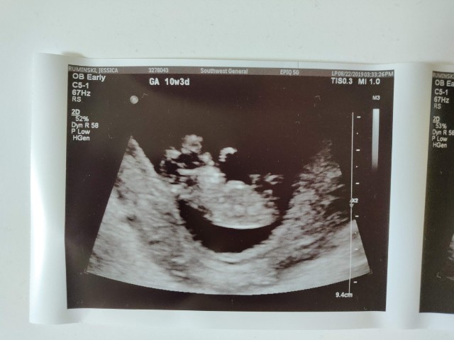 10 Weeks 3 Days Pregnant Ultrasound