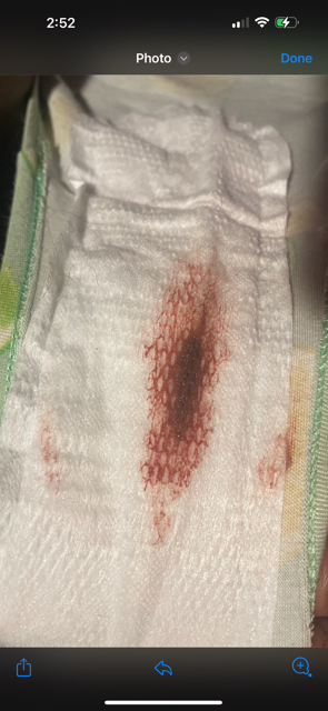 IS THIS BREAKTHROUGH BLEEDING OR IMPLANTATION - Glow Community