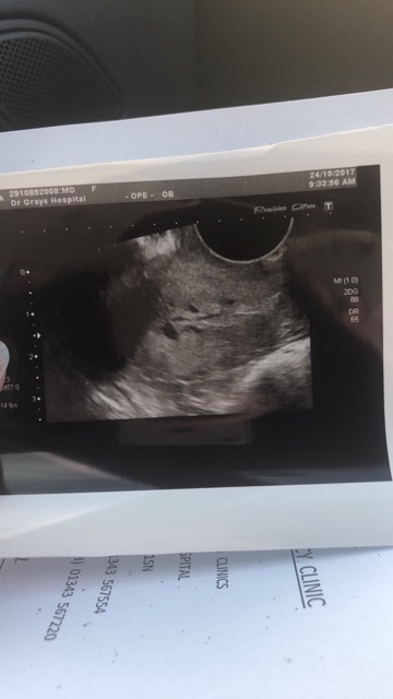 5 week scan - Glow Community