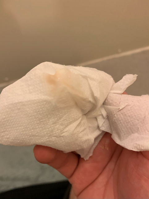 Creamy pink discharge... implantation? - Glow Community