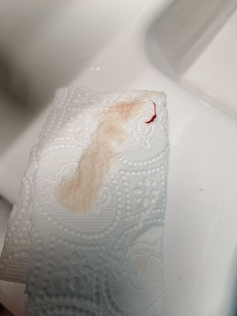 Mucus plug, bloody show or something else? - Glow Community