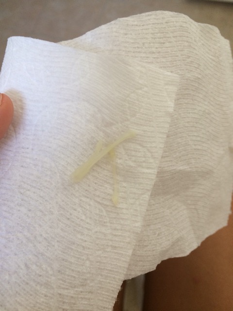 Yellow, Stretchy CM at 11dpo - Glow Community