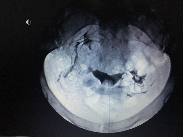 Abnormal Uterus Glow Community