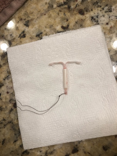 My iud fell out!!! TMI photo - Glow Community