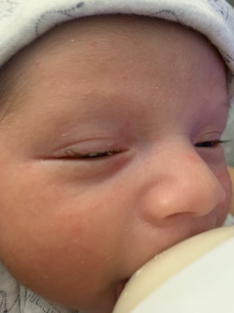 what causes eye boogers in babies? My baby is 3 weeks old and just ...