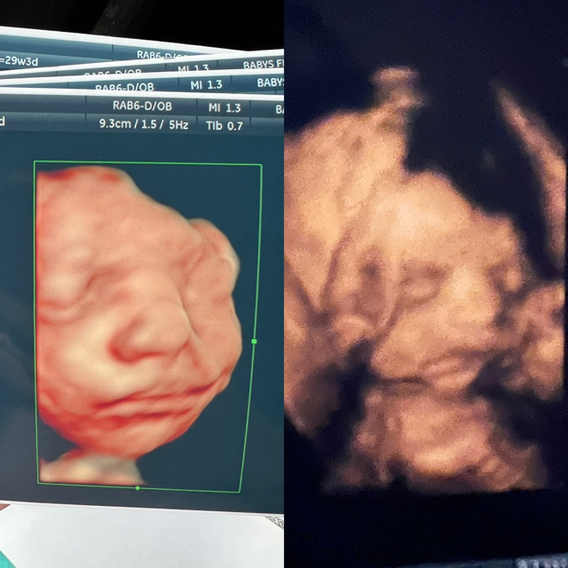 Got our 4D scan. Left is baby boy ( currently 29weeks 4 days) right is ...