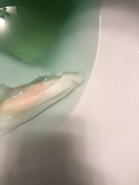 Implantation Bleeding? 8DPO. Update: stopped bleeding, mild cramps ...