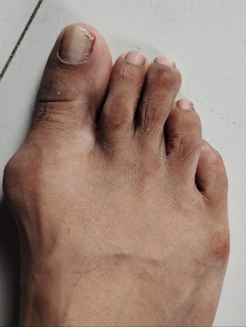 Third toe is longest 👣 - Glow Community