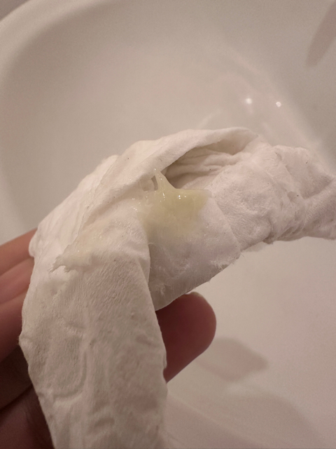 38w 1day not too much white discharge like before but thìs type little ...